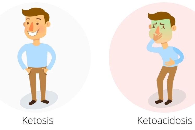 ¿Qué es la cetosis? Beneficios y riesgos